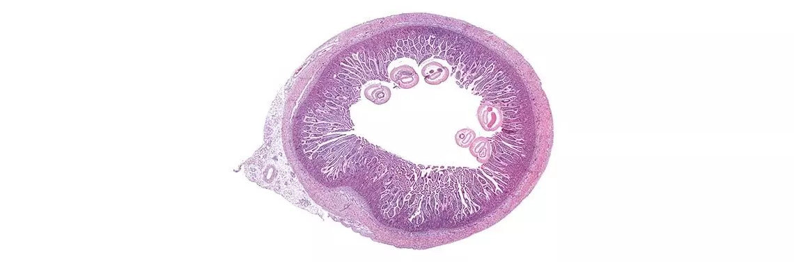 Owsica u dzieci (enterobioza, enterobiosis) - Czasopismo dla lekarzy ...