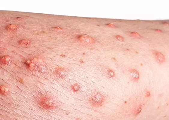 Zaburzenia rozwoju mowy u dzieci - Czasopismo dla lekarzy pediatrów ...